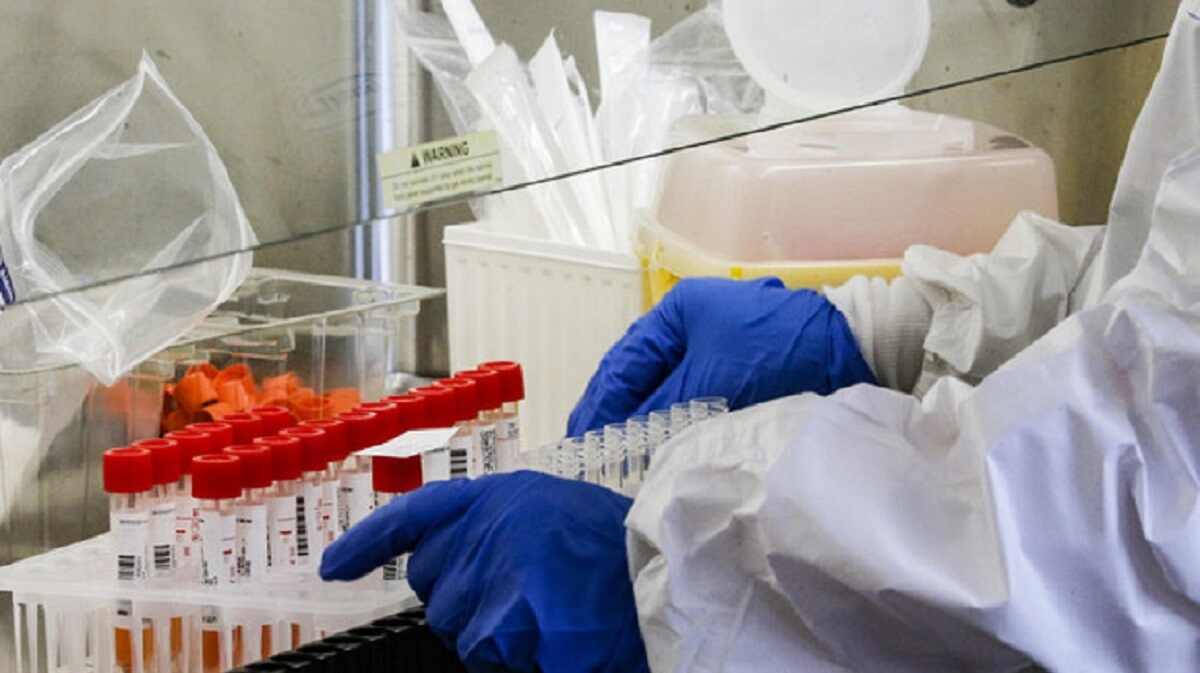 Sviluppato sangue universale per trasfusioni a tutti i gruppi sanguigni