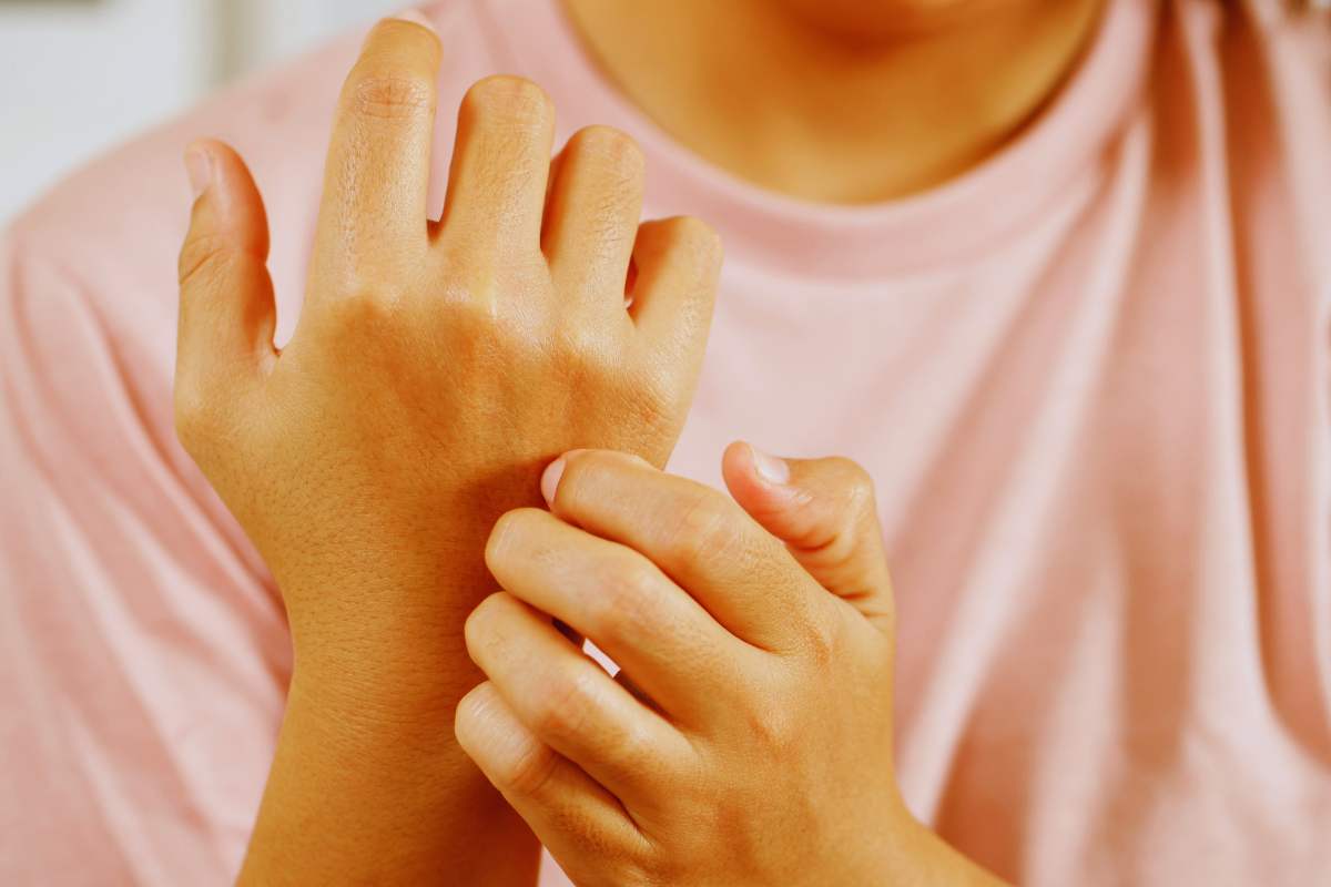Prurito alle mani, non è un sintomo da sottovalutare: quando è urgente ...