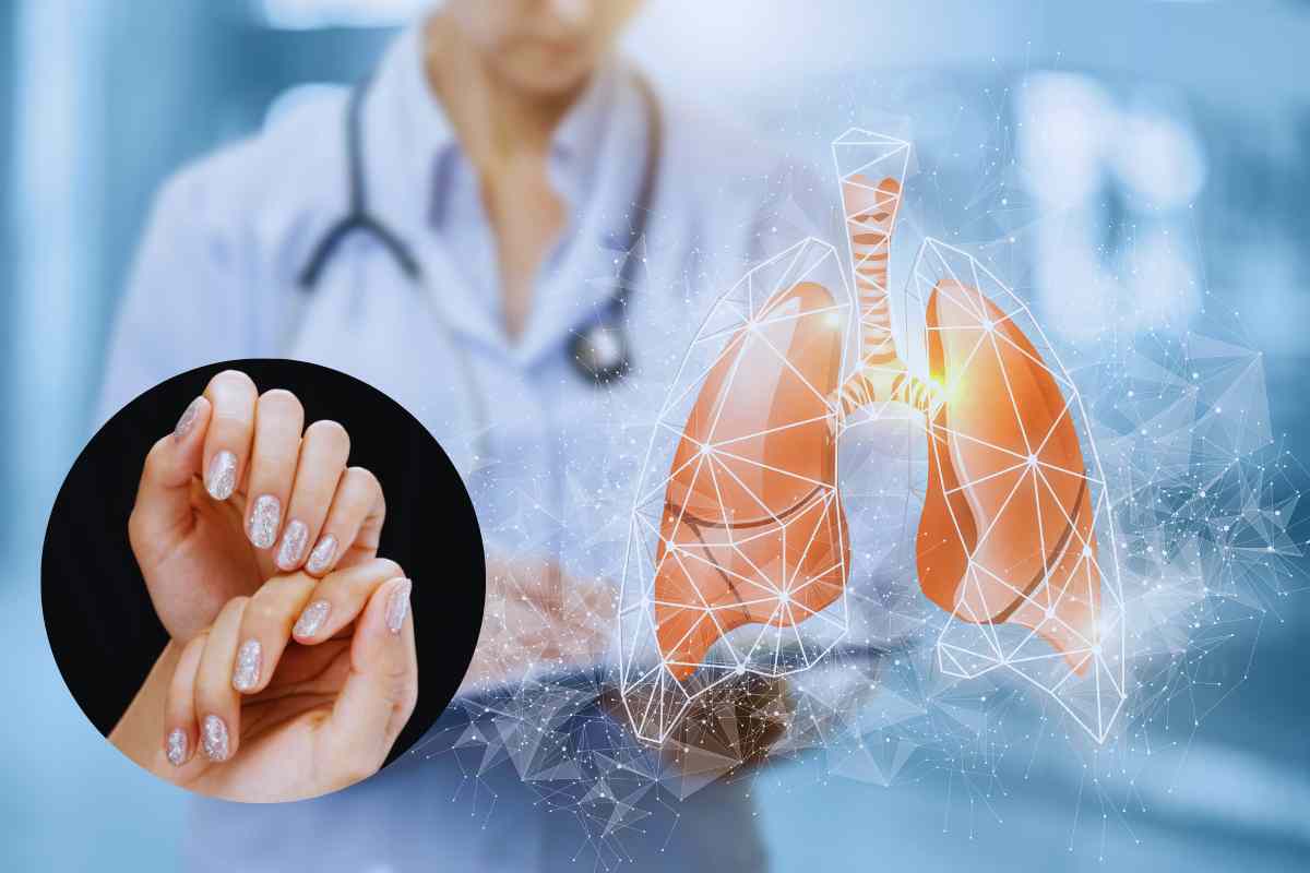 Polmoni: con questo test di 5 secondi sulle unghie scopri in anticipo ...
